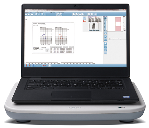 コンパクトながら幅広い検査に対応した誘発反応検査装置「Audera® Pro」を発売 | リオンのプレスリリース | 共同通信PRワイヤー